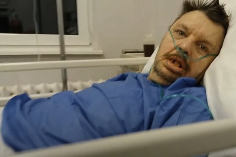 Krzysztof Kononowicz w fatalnym stanie przebywa w szpitalu - Espresso